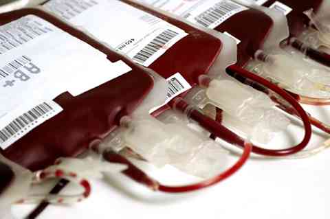 NBSZ appeals for more blood donations - Zimbabwe Situation